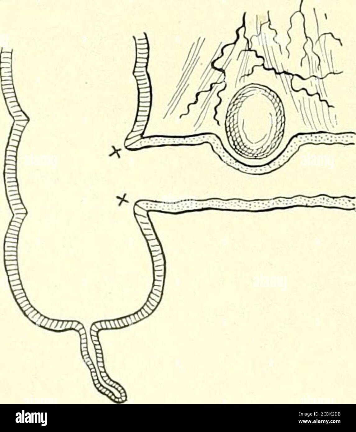 . Surgery, its principles and practice . al study, theothers reported ...