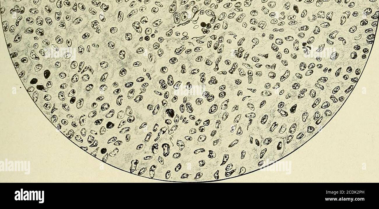 . Gynecology : . ^ *8cr? iC@ ?;tf/ • cs^^^^ ££ §smh. Fig. 162.—Round ...