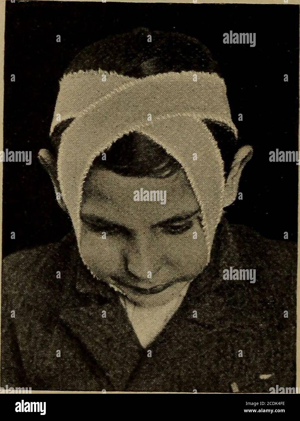 . Minor surgery and bandaging, including the treatment of fractures and ...