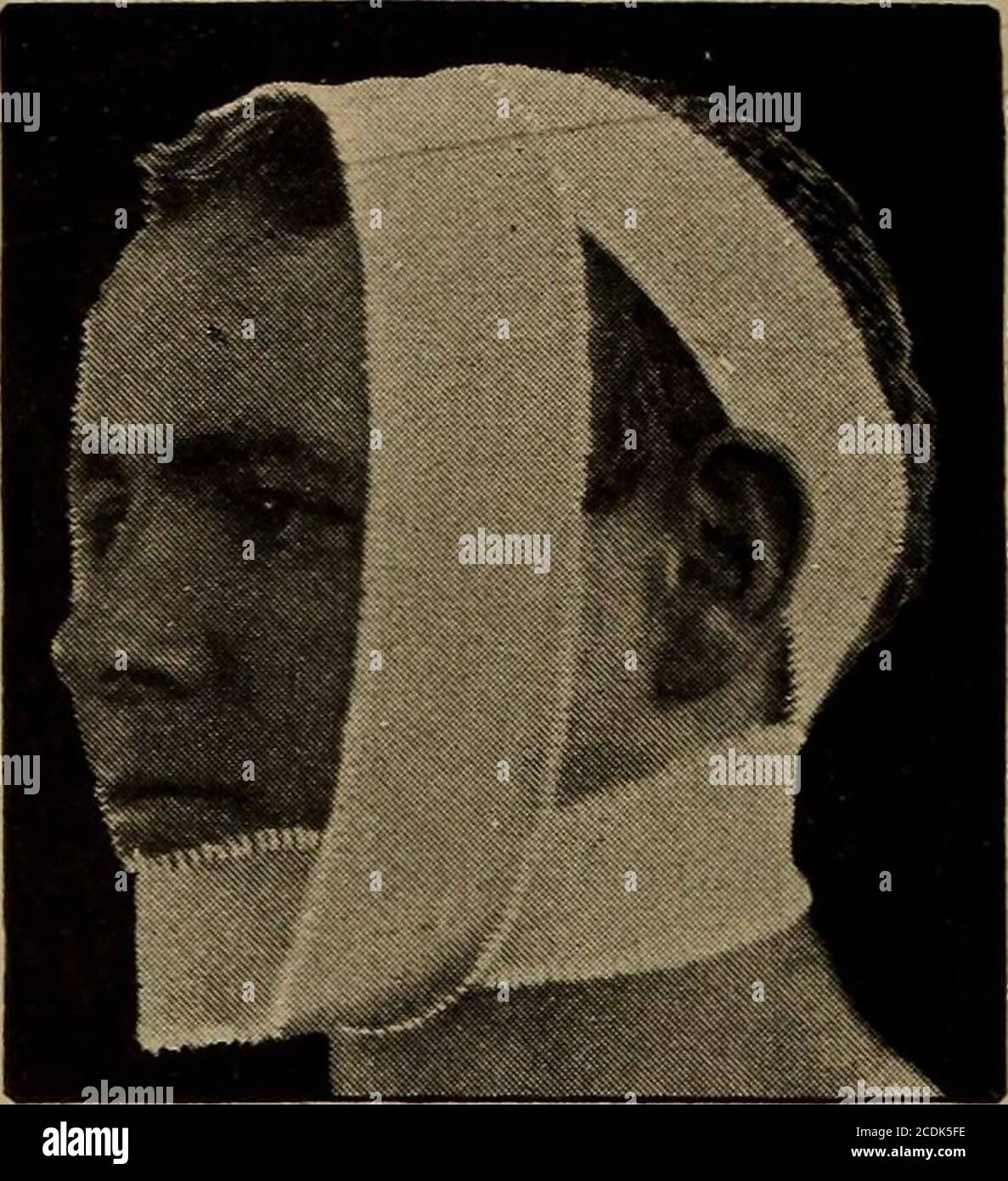 . Minor surgery and bandaging, including the treatment of fractures and ...