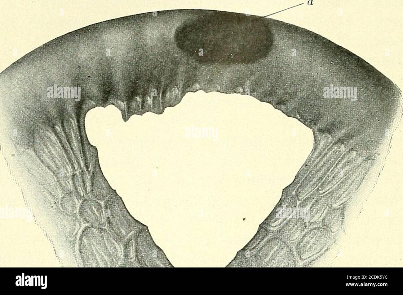 Transversecolon hi-res stock photography and images - Alamy