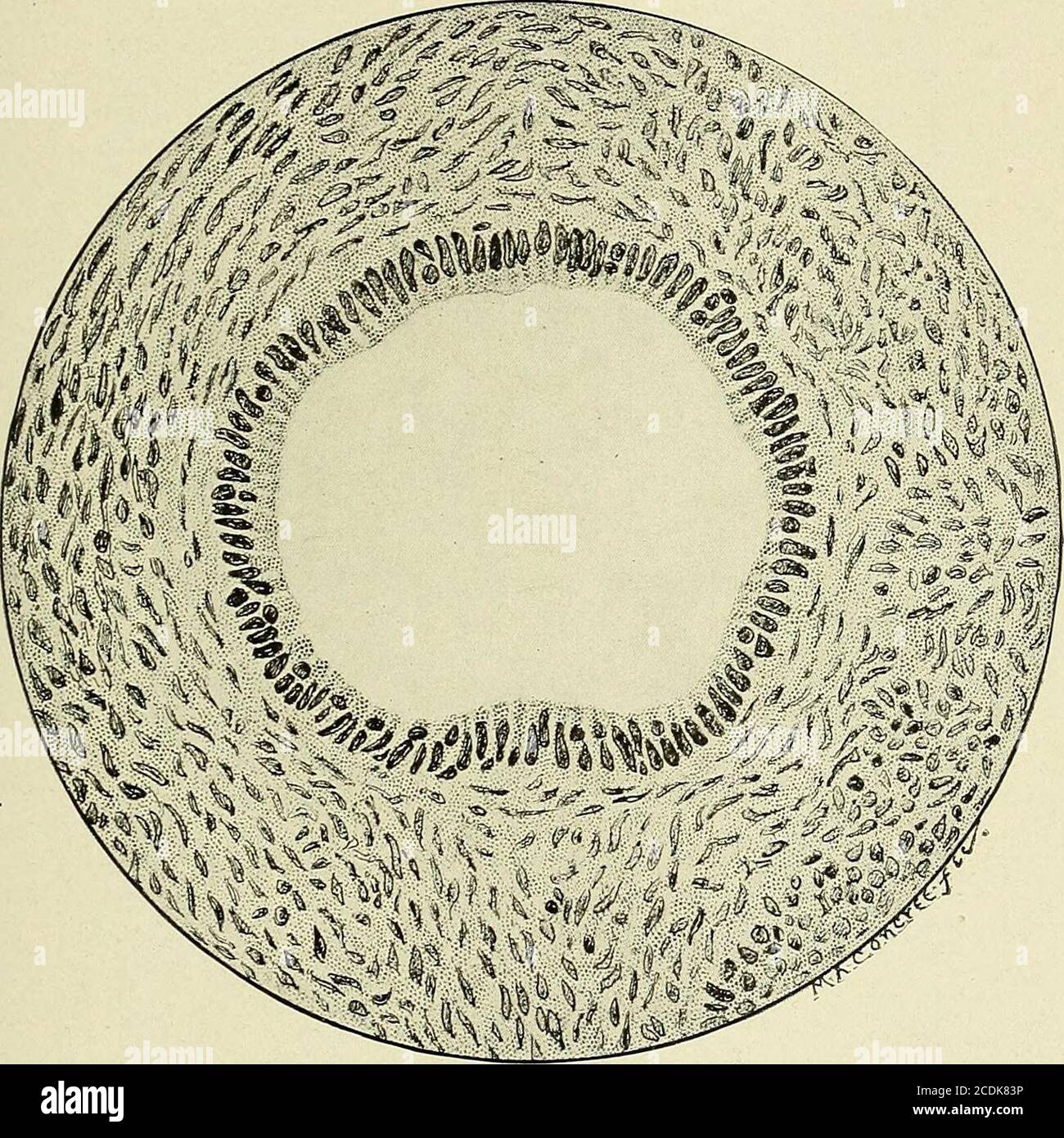 Exposed cortex hi-res stock photography and images - Alamy