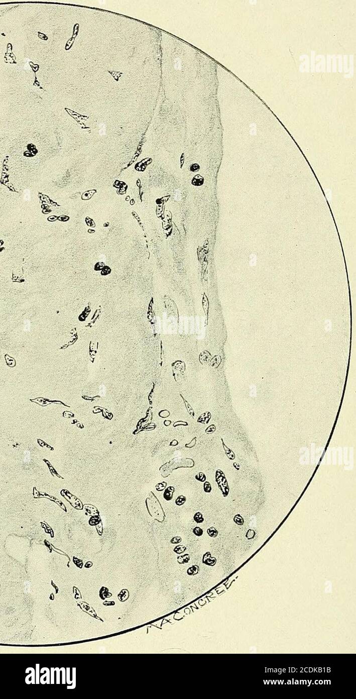 . Gynecology : . m follicle cysts in that they represent a ...
