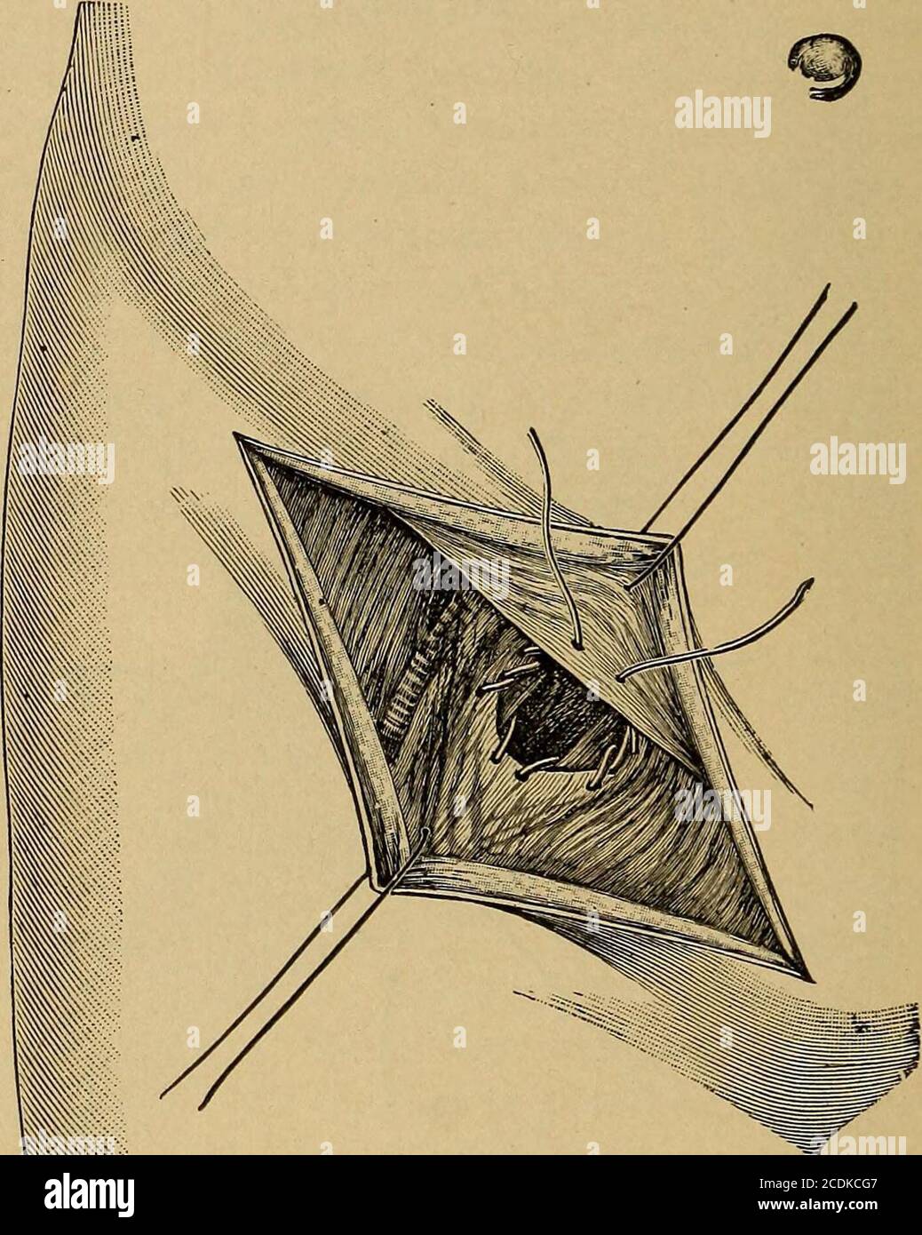 . Minor and operative surgery, including bandaging . Operation for the ...