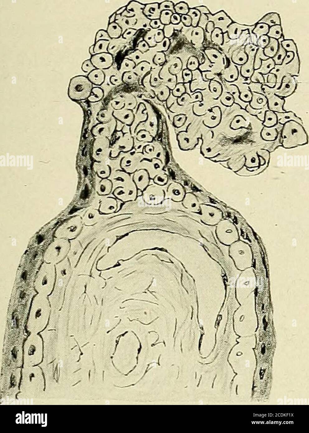 Fetal tissue hi-res stock photography and images - Alamy