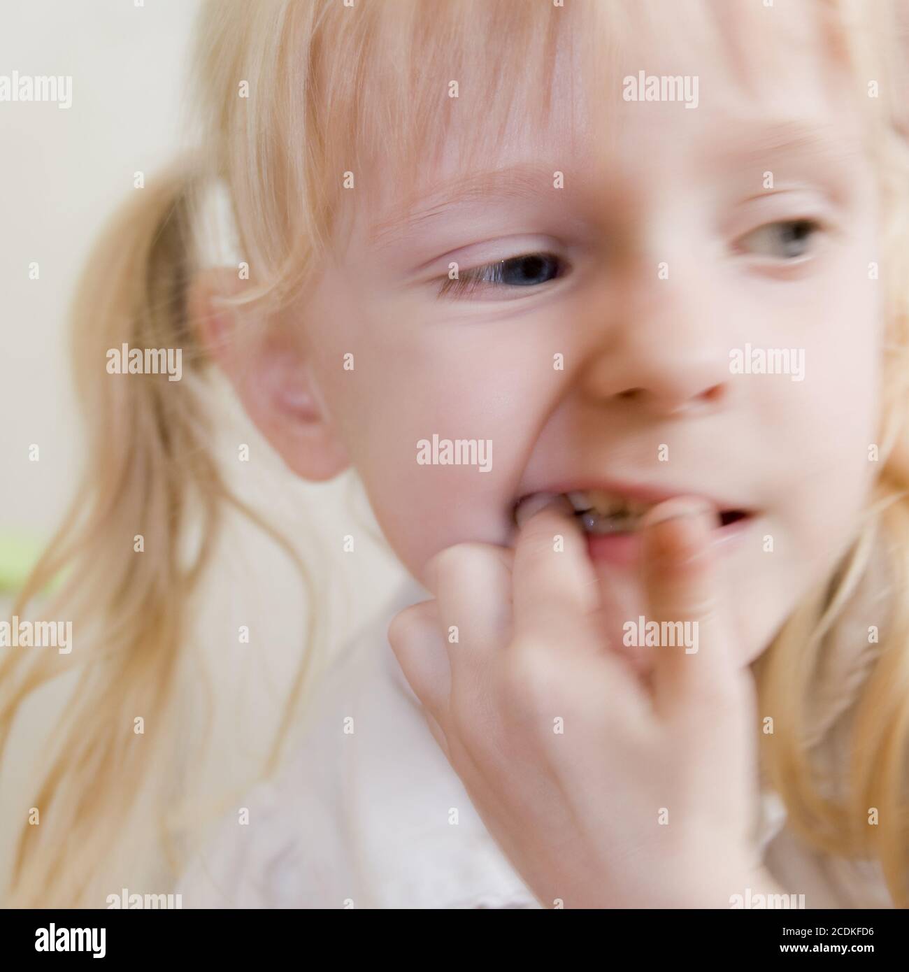 Loose tooth hi-res stock photography and images - Alamy