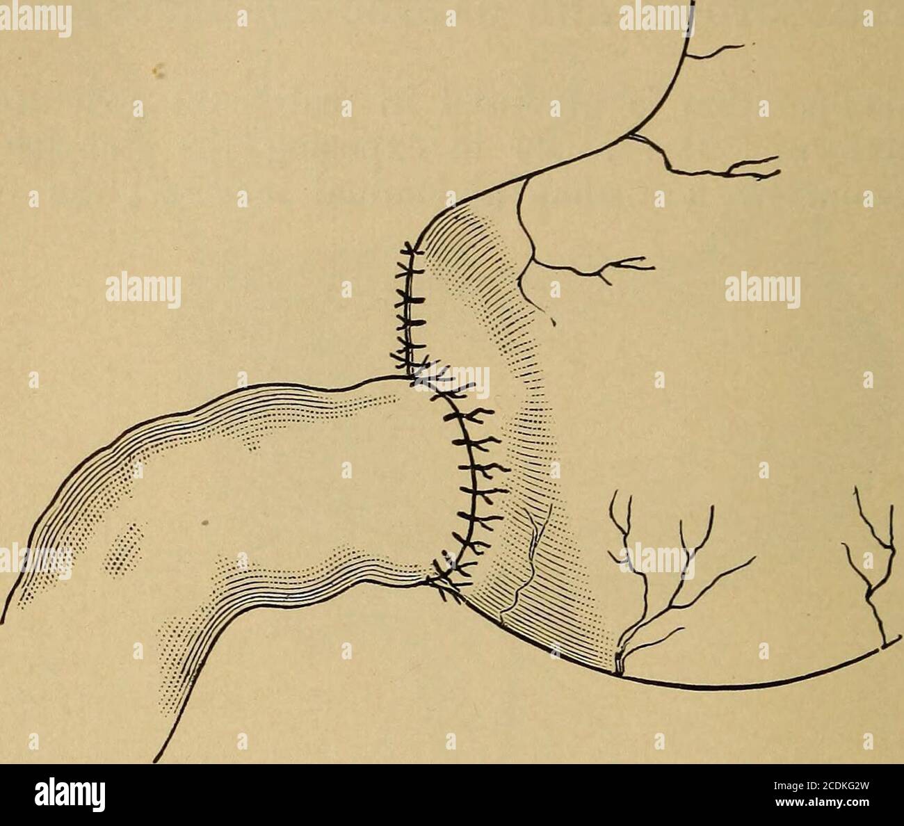 . Minor and operative surgery, including bandaging . Pylorus excised ...