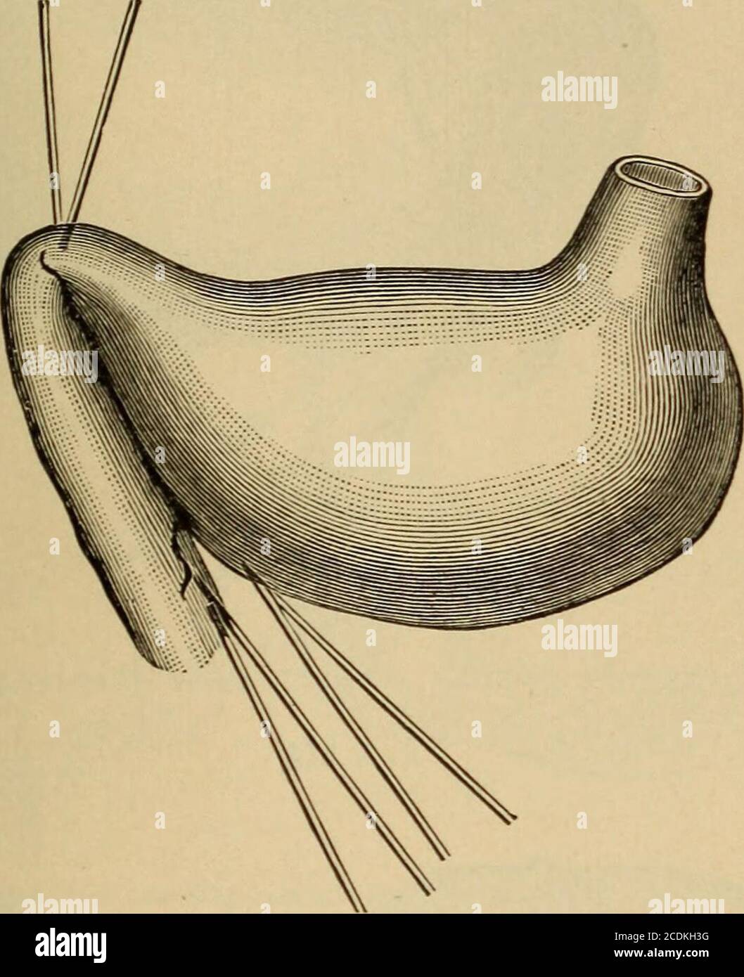 . Minor and operative surgery, including bandaging . Incision closed ...