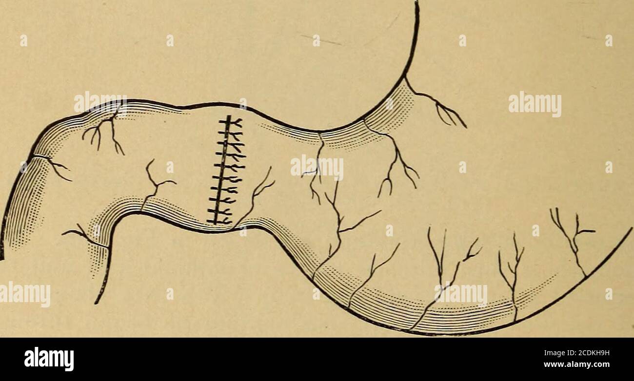 . Minor and operative surgery, including bandaging . Incision in ...