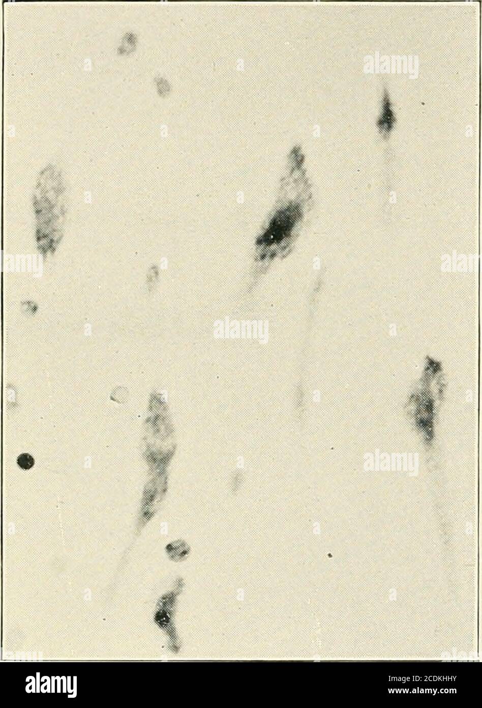 Cresyl violet stain hi-res stock photography and images - Alamy