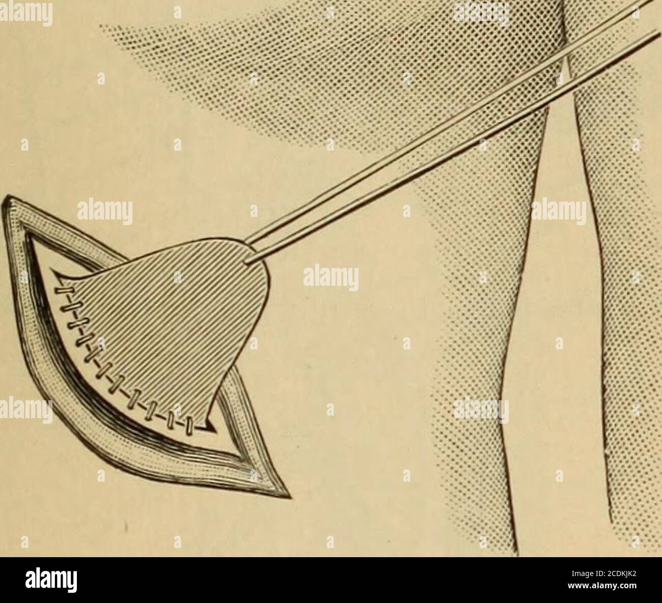 . Minor and operative surgery, including bandaging . us incised upon ...