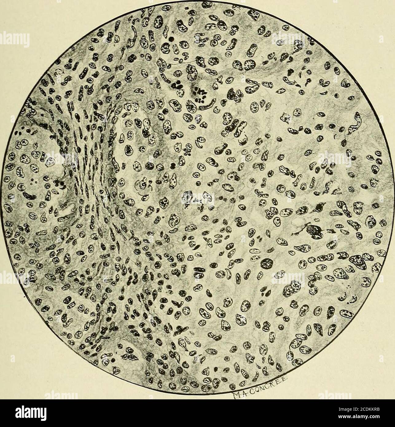 Basal lamina or basement membrane hi-res stock photography and images ...
