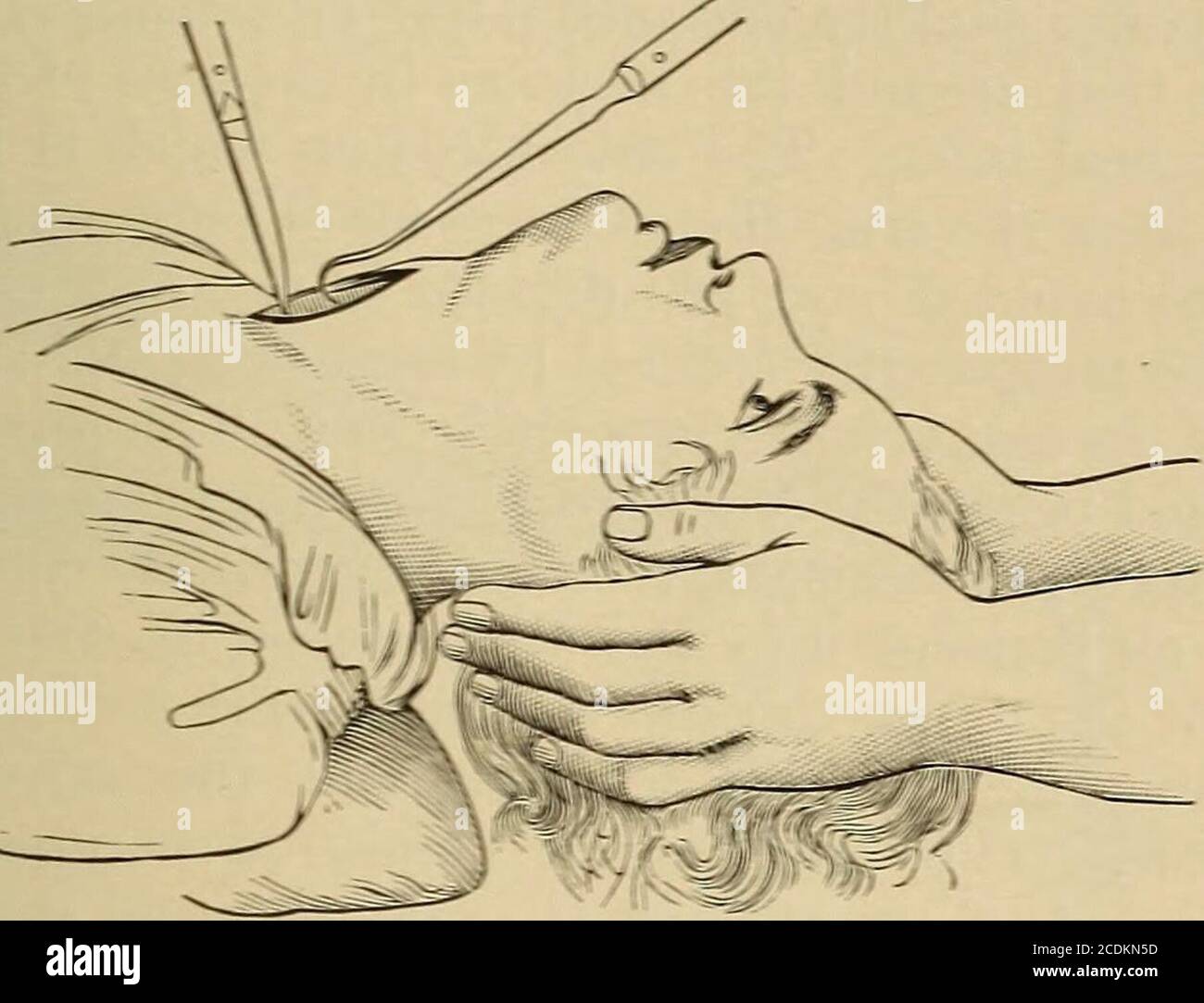 . Minor and operative surgery, including bandaging . n inch in length ...