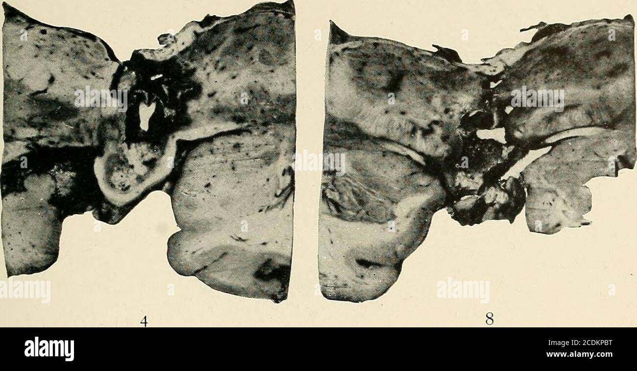 . Bulletin of the Massachusetts Department of Mental Diseases . X 10 ...