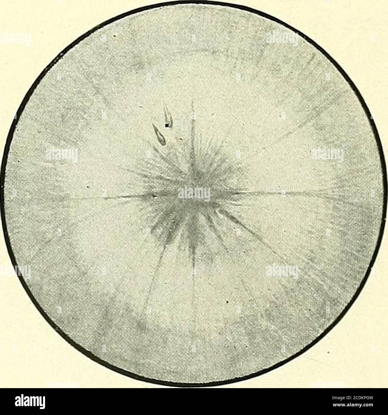 . Surgery, its principles and practice . Fig. 280.—Penoscrotal Junction ...