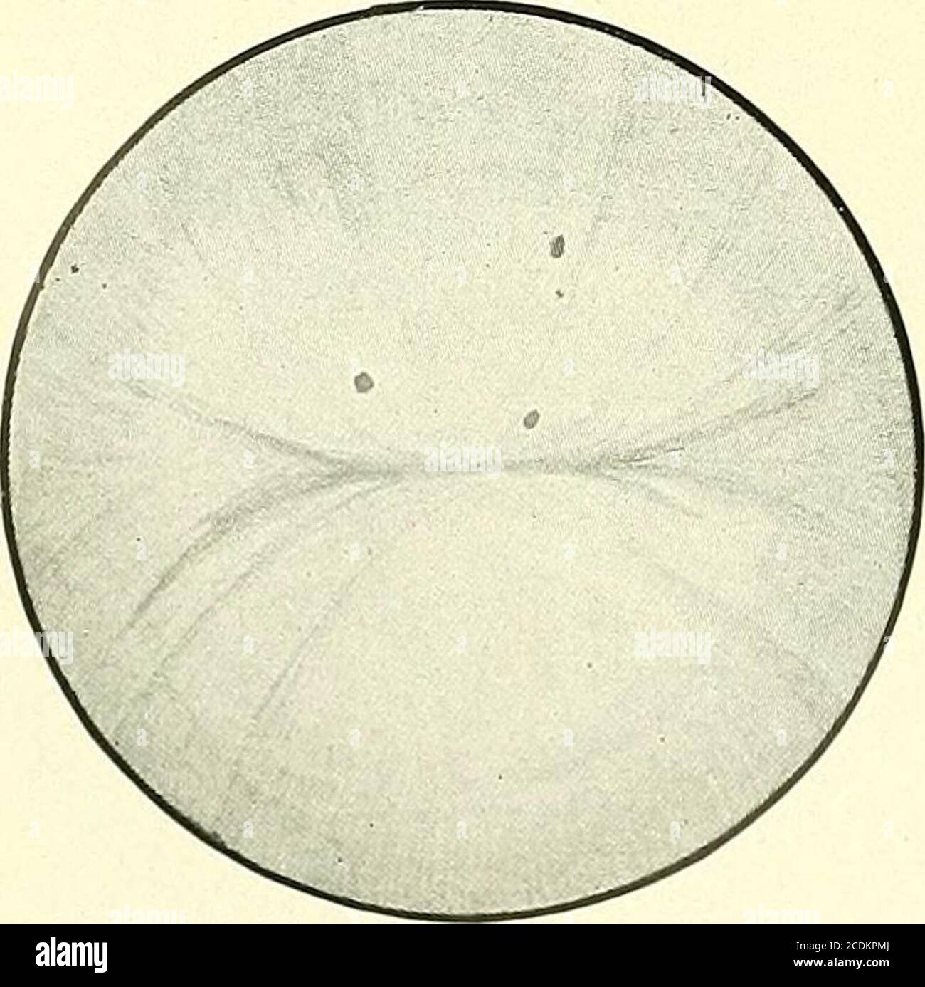 . Surgery, its principles and practice . Fig. 278.—BuLBors Urethra ...