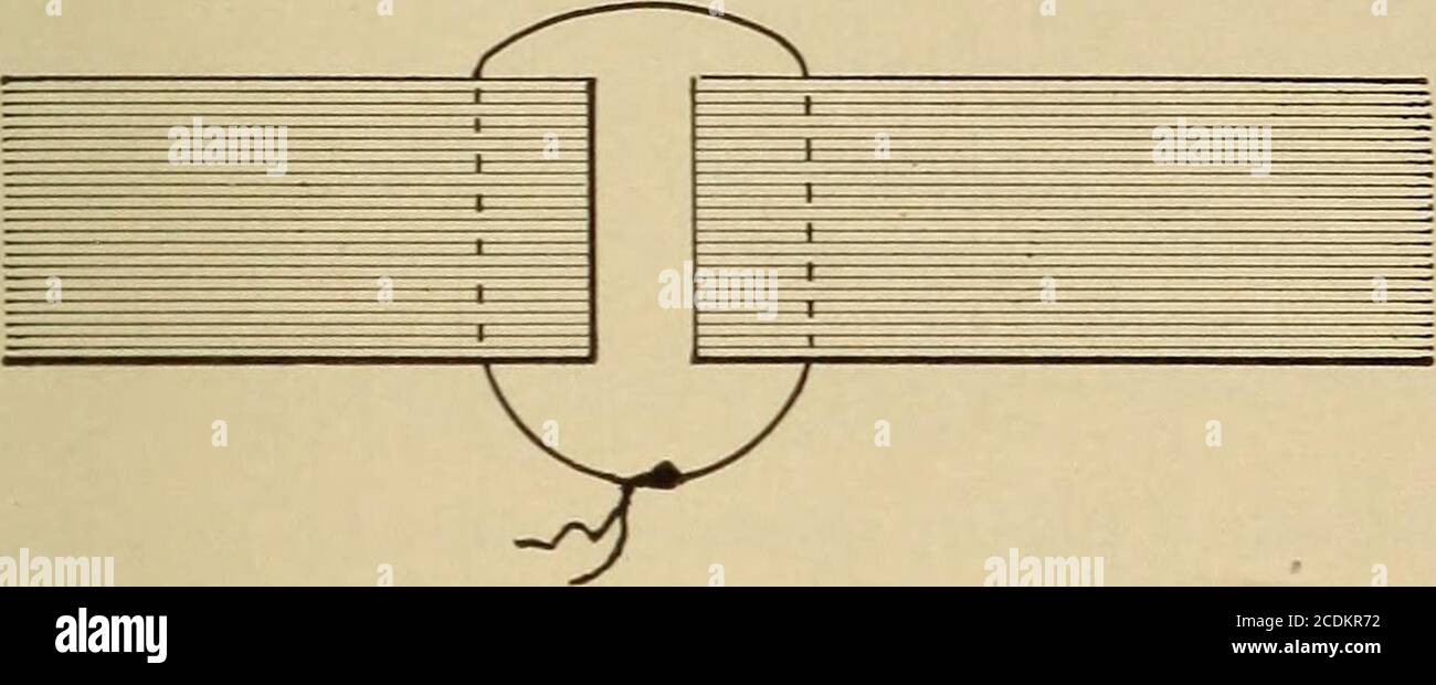 . Minor and operative surgery, including bandaging . Tenotomy of sterno ...