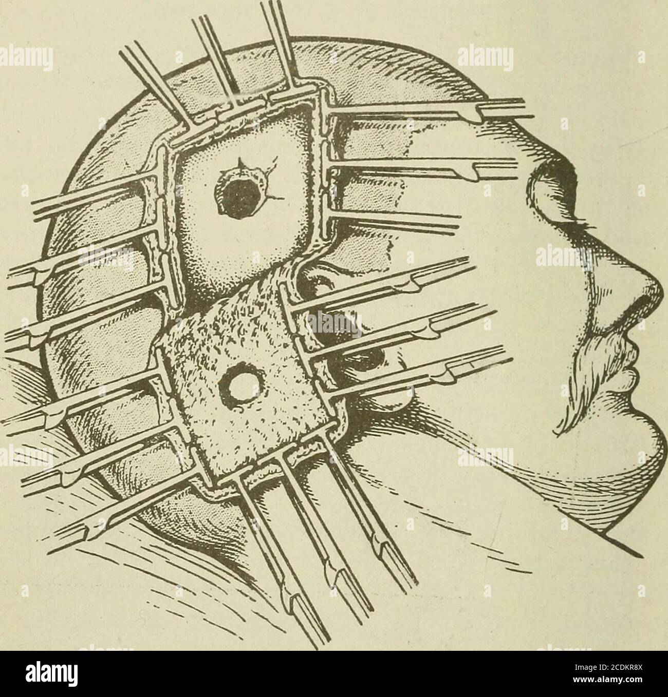 . Medical and surgical therapy . e procedurepointed out above, but in ...