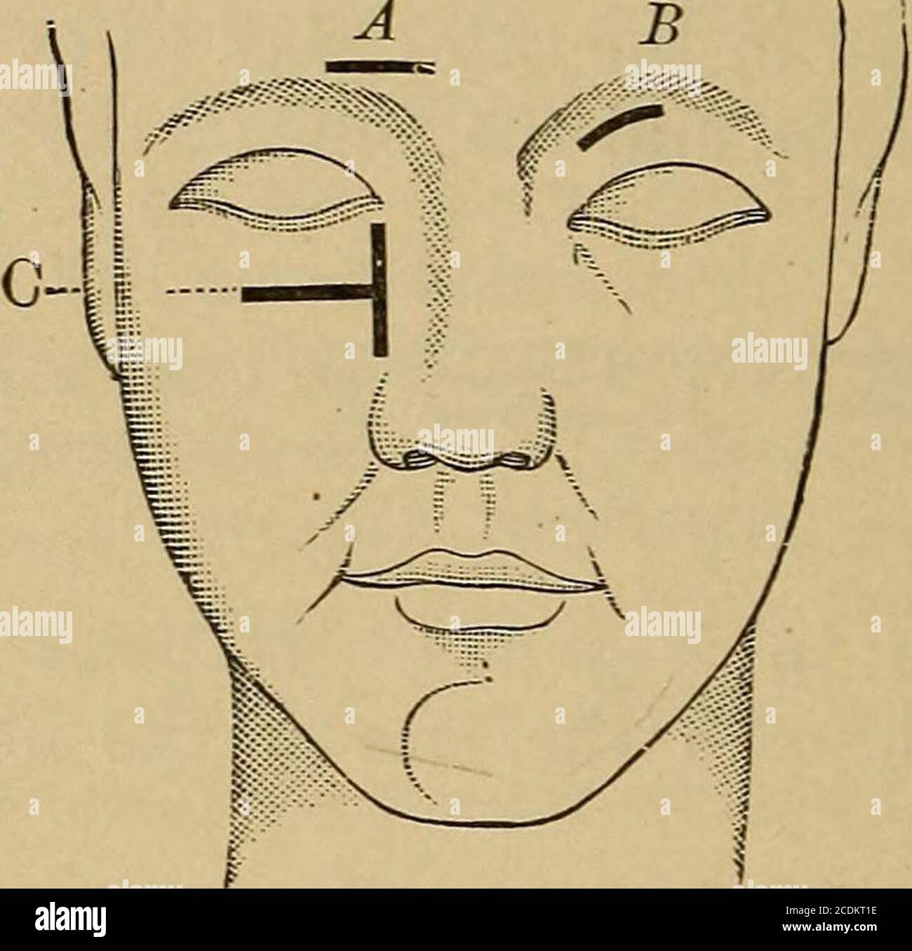 . Minor and operative surgery, including bandaging . tretched as may be ...