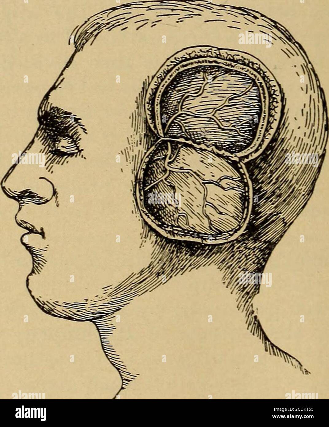 . Minor and operative surgery, including bandaging . Fig. 472 ...