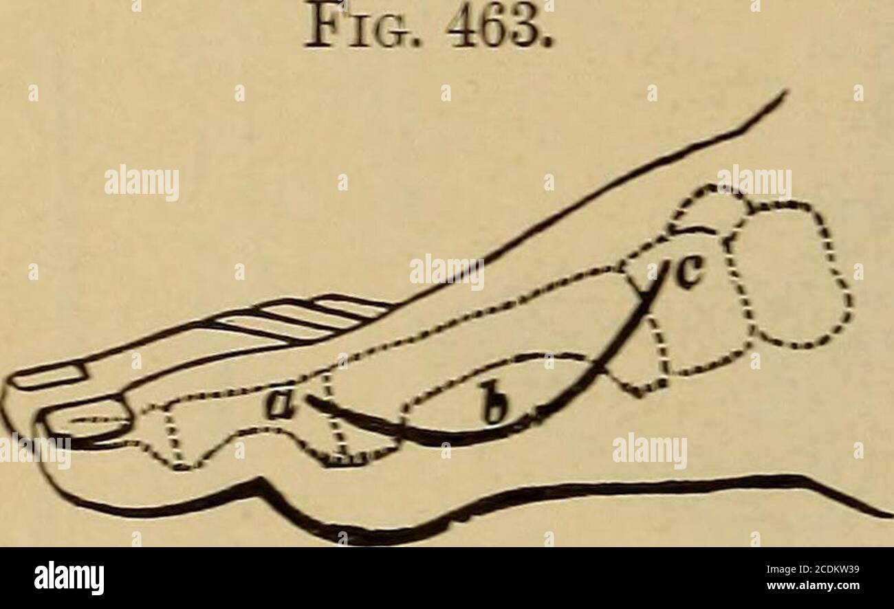 . Minor and operative surgery, including bandaging . semilunar incision ...