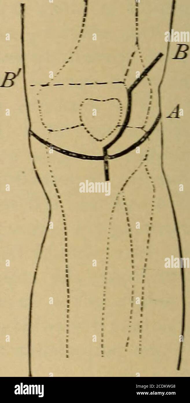 . Minor and operative surgery, including bandaging . Incision for ...