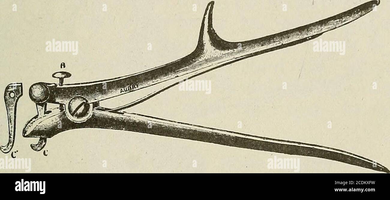 . Medical and surgical therapy . Fig. 39.—The flap is deeply fissured ...