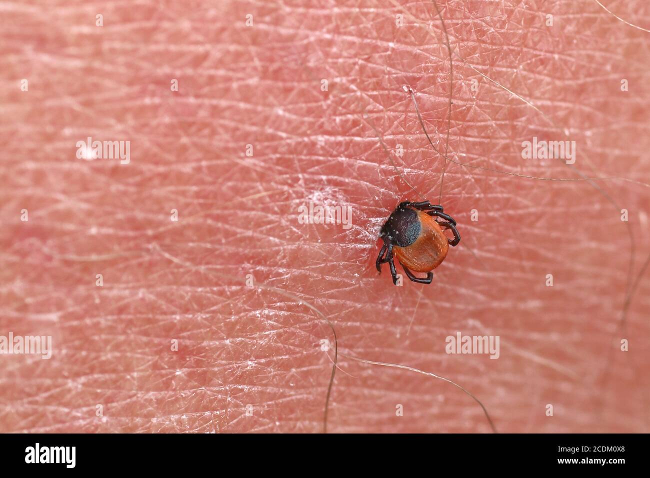 European castor bean tick, European sheep tick (Ixodes ricinus), female ...