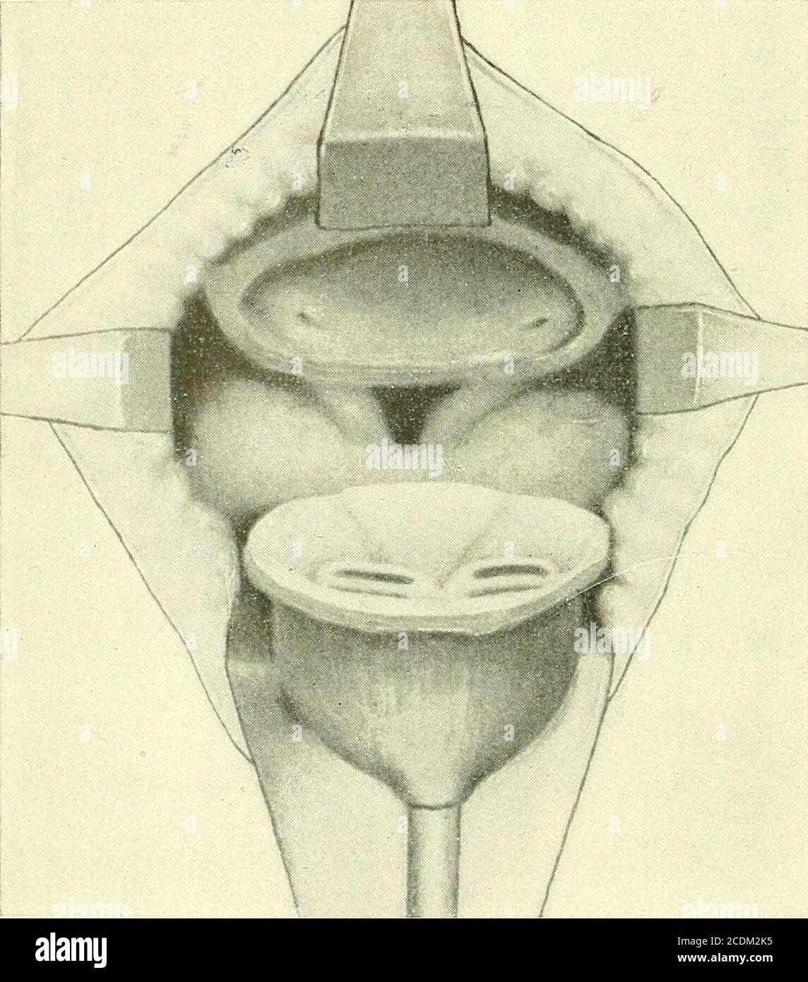 . Surgery, its principles and practice . siveperitoneal meta-stases had ...