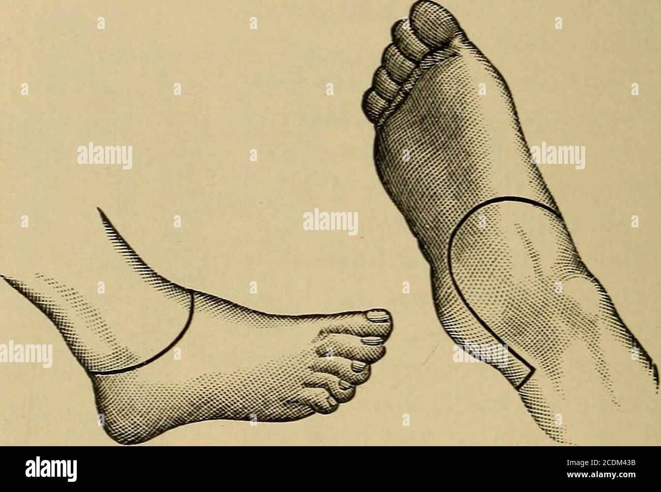 . Minor and operative surgery, including bandaging . AMPUTATIONS OF THE ...