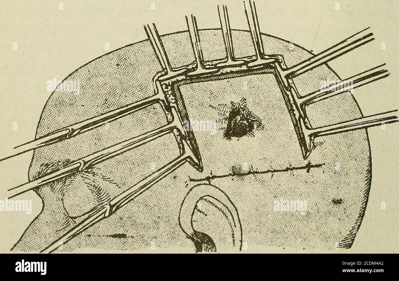 . Medical and surgical therapy . 5lfflS!?SSP?S?;?SS^ifS/?S§si ^ Fig. 14 ...