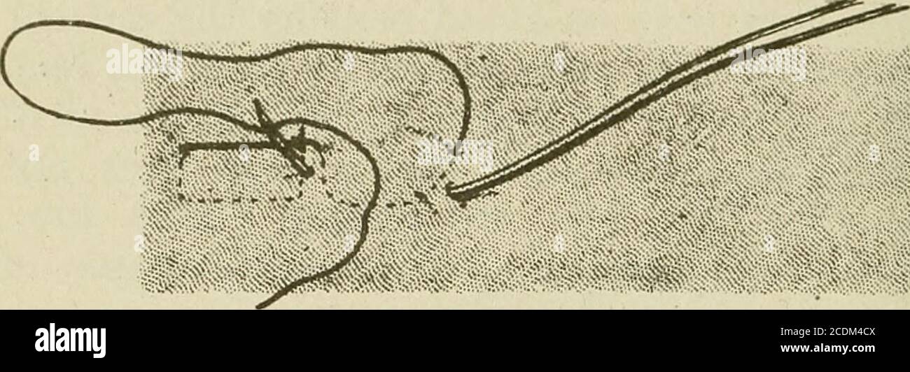 . Medical and surgical therapy . 5lfflS!?SSP?S?;?SS^ifS/?S§si ^ Fig. 14 ...