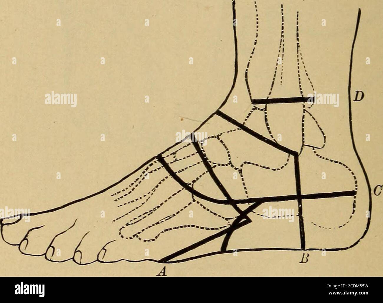 . Minor and operative surgery, including bandaging . romi-nence ...