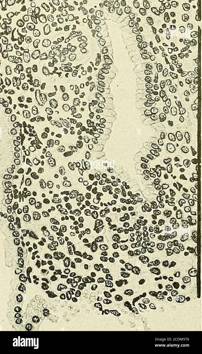 Endocervix hi-res stock photography and images - Alamy