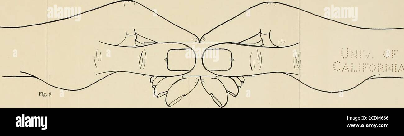 . An introduction to therapeutic inoculation . PREPARATION OF SPREADER ...