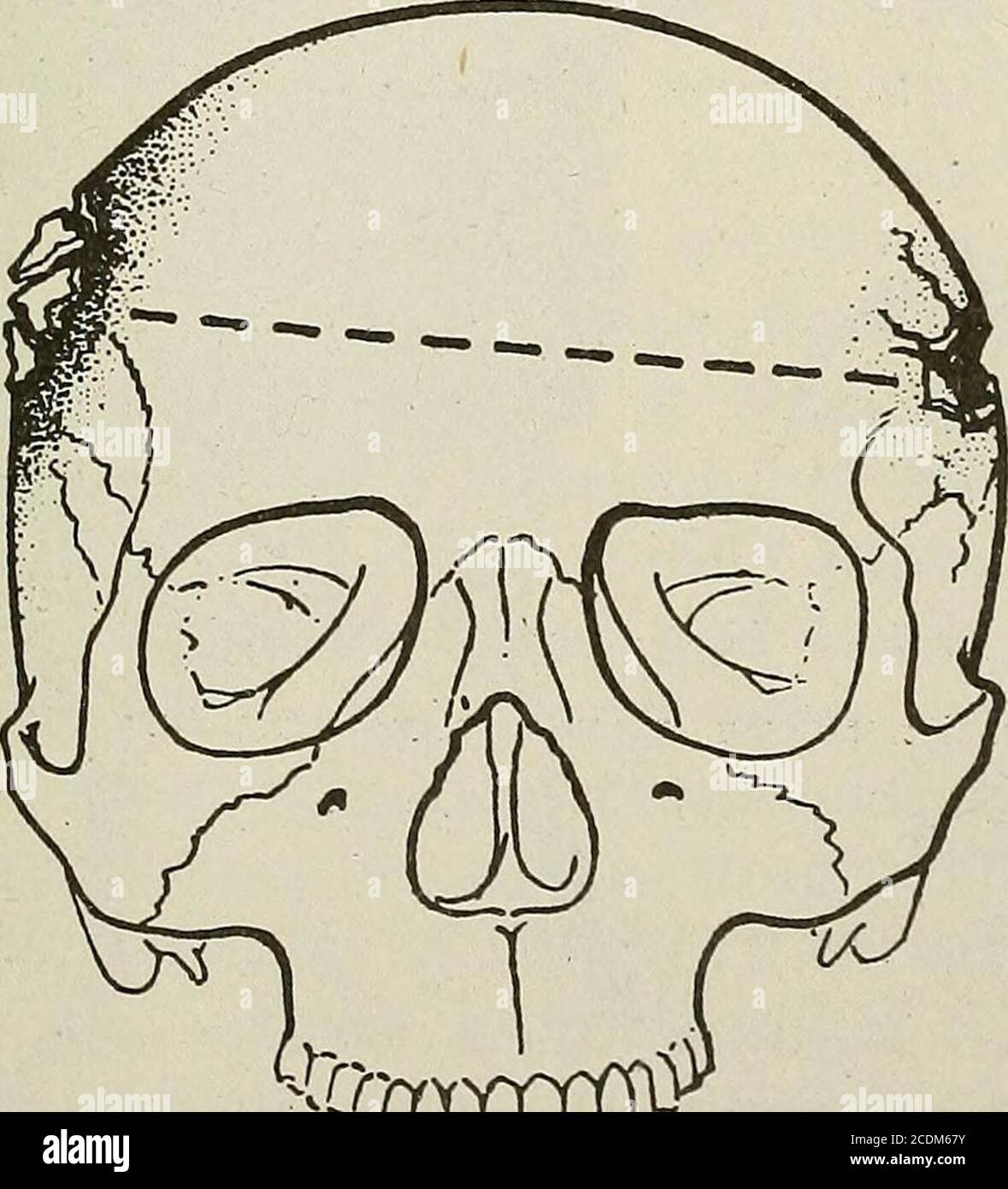 Brain and skull from side hi-res stock photography and images - Alamy