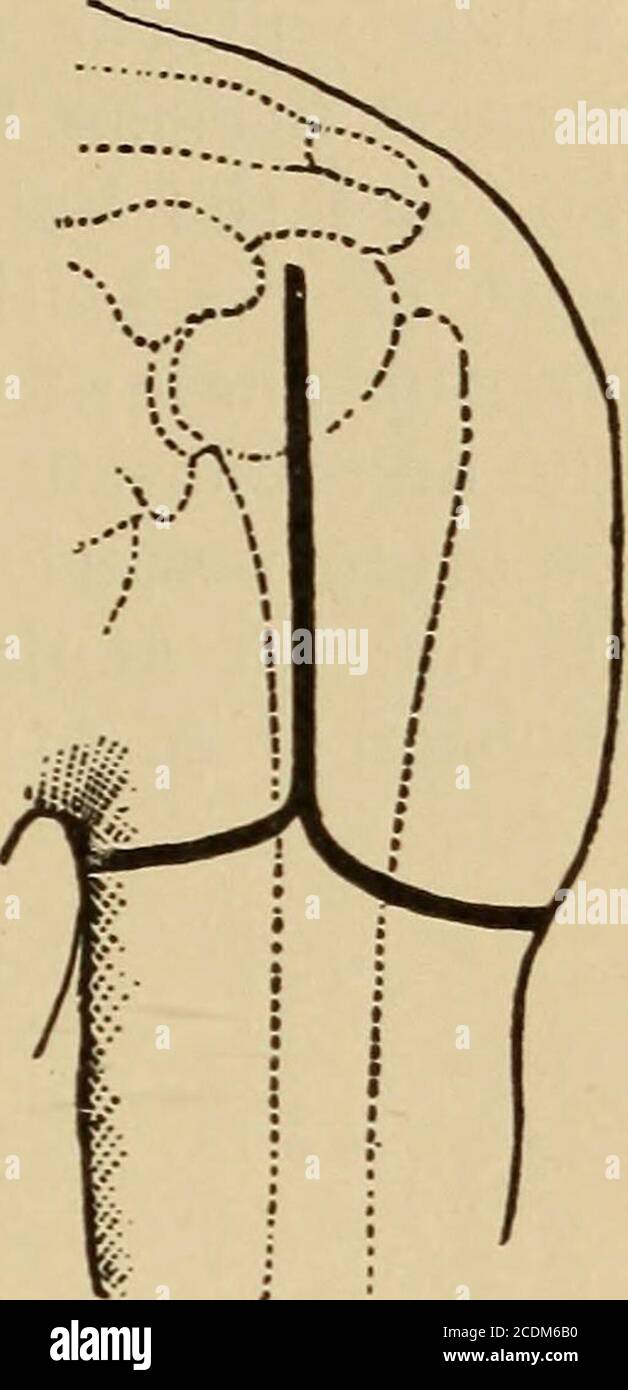 . Minor and operative surgery, including bandaging . d by dividing ...