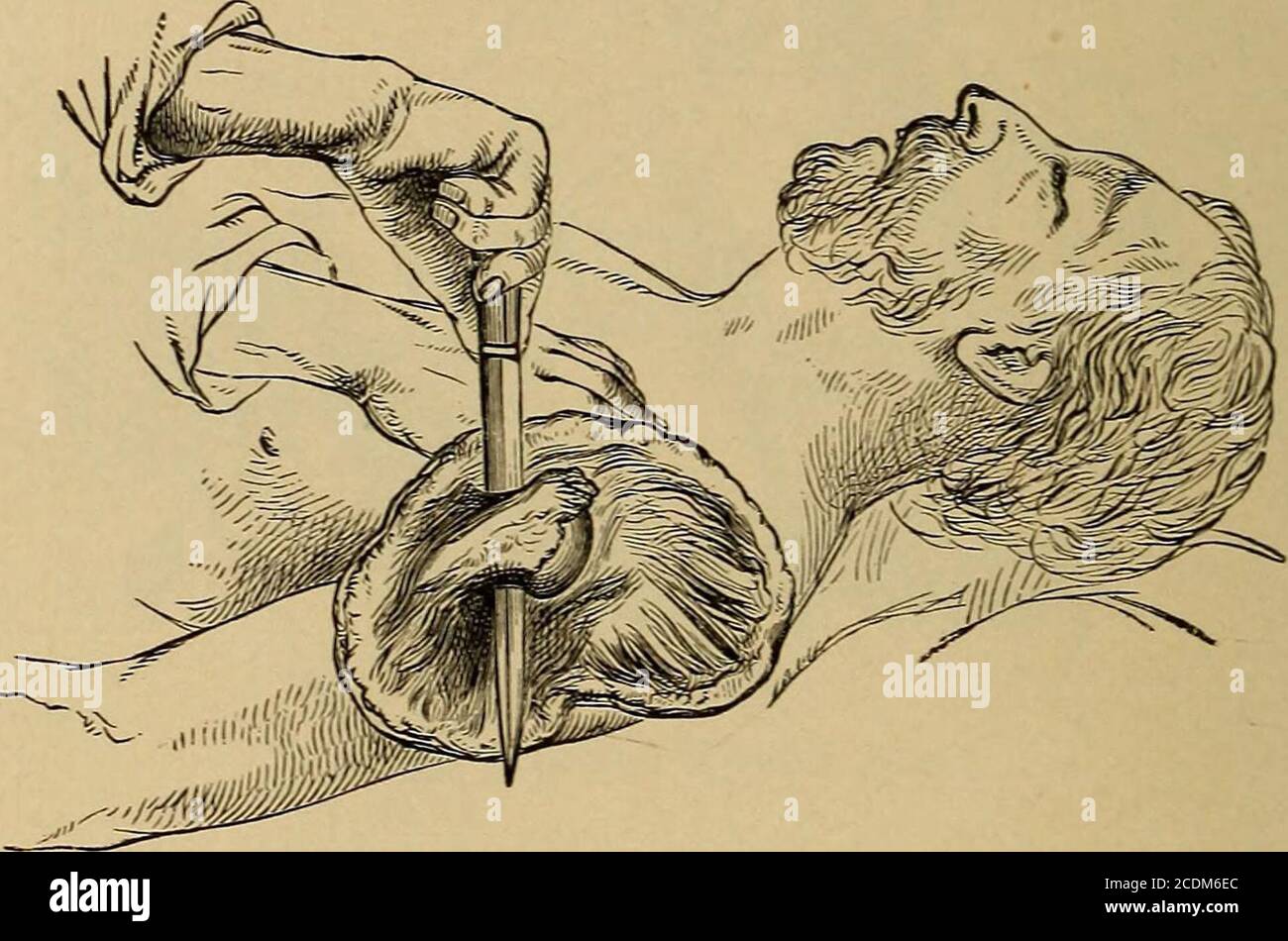 . Minor and operative surgery, including bandaging . ind the bone and ...