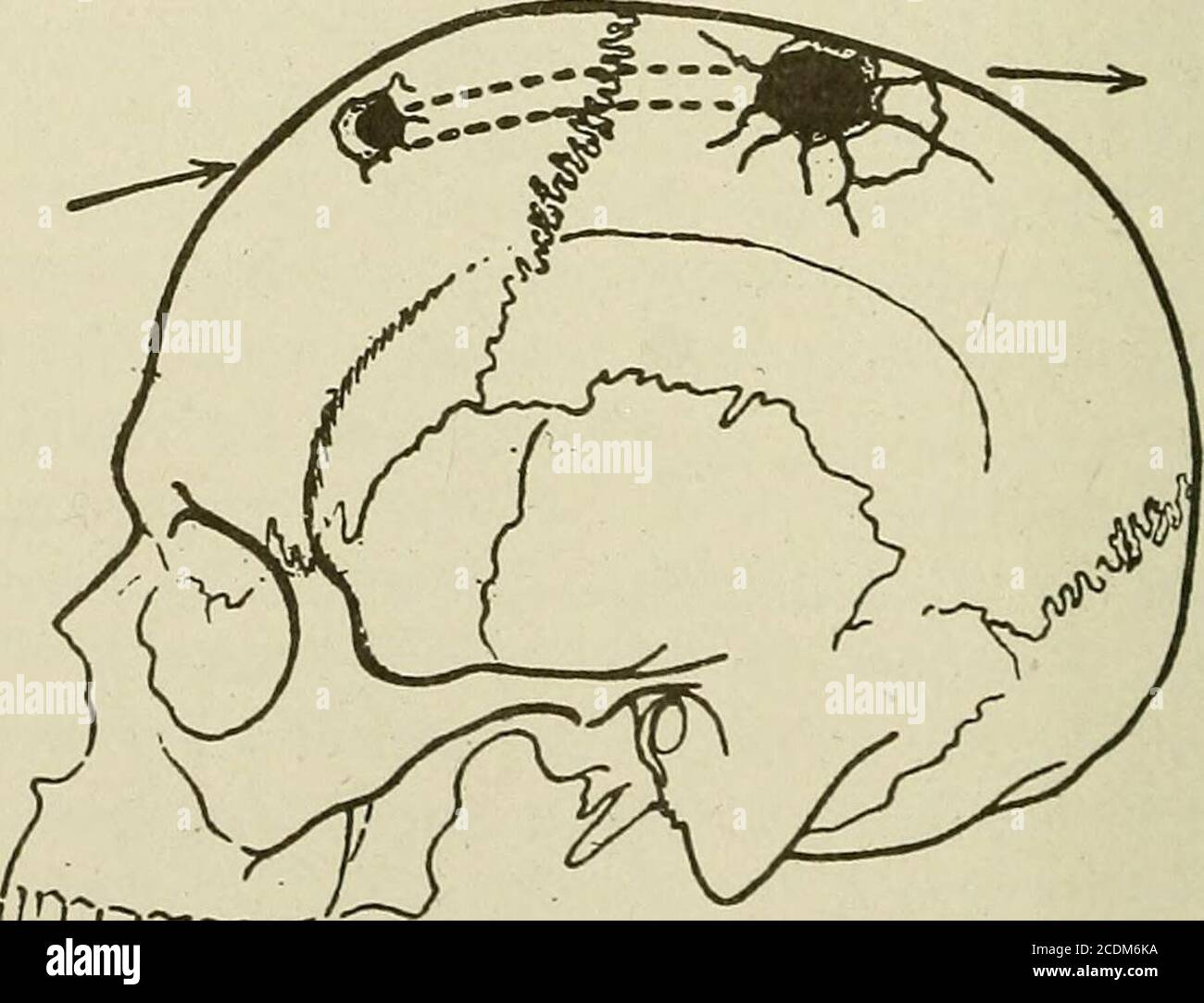 Wound in a circle hi-res stock photography and images - Alamy