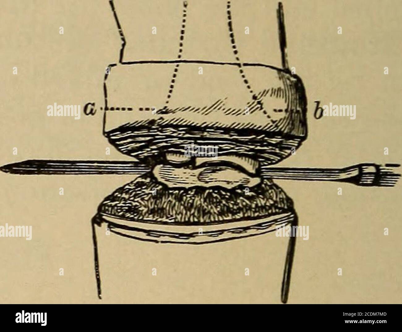 . Minor and operative surgery, including bandaging . Circular ...