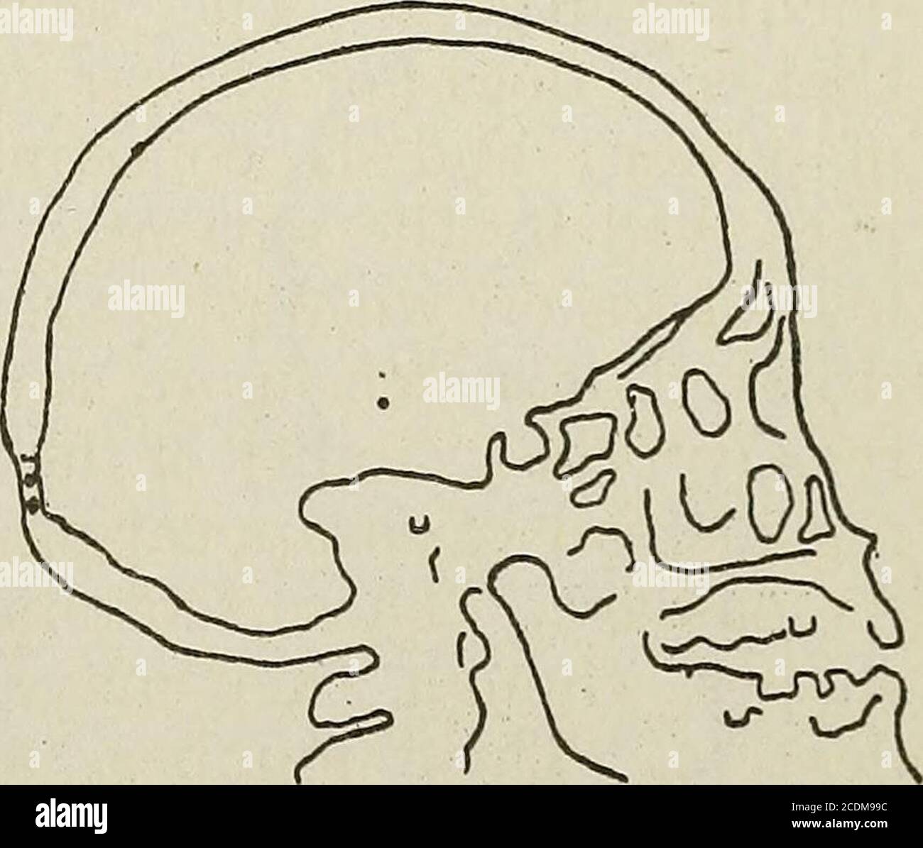 . Medical and surgical therapy . Fig, 20,—The wound of the skull. Fig ...