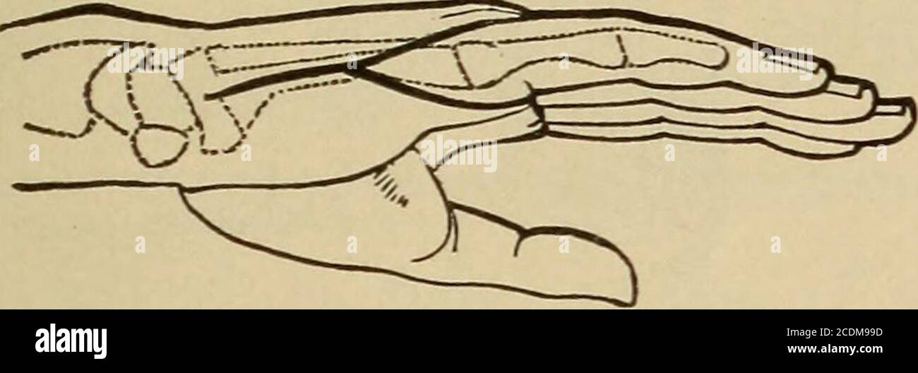. Minor and operative surgery, including bandaging . one. (Skey.) In ...