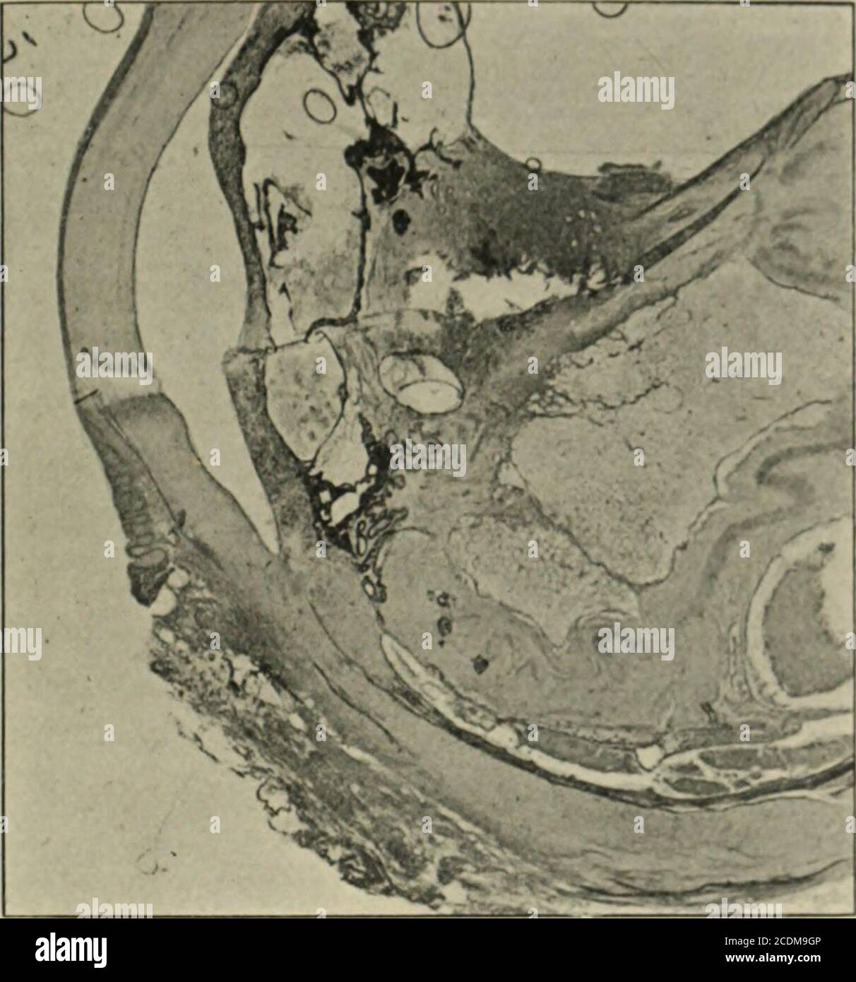 Conjunctival sac hi-res stock photography and images - Alamy