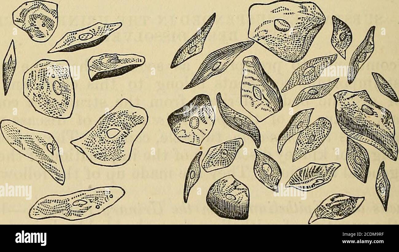. The science and practice of medicine . * Epithelium from the bladder ...