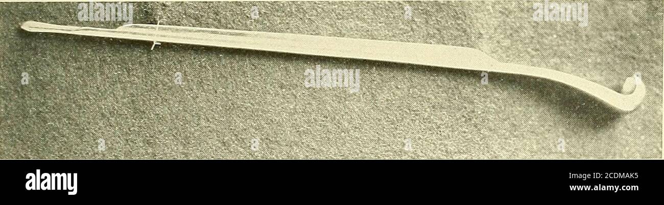 Suprapubic hi-res stock photography and images - Alamy