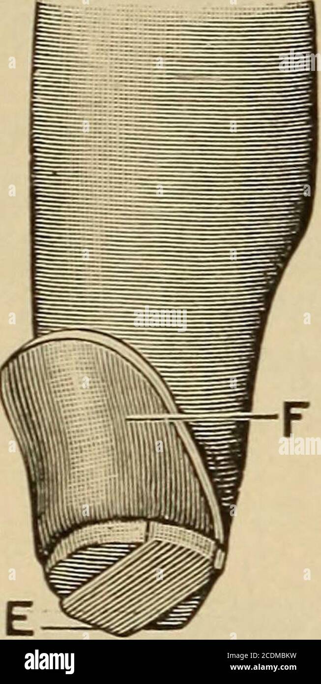 . Minor and operative surgery, including bandaging . Biers osteoplastic ...