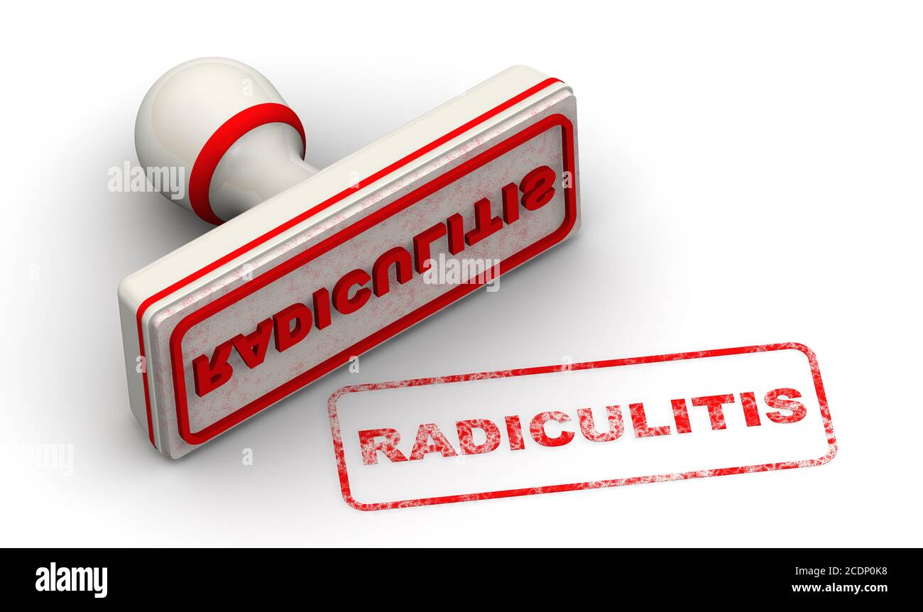 Radiculitis. The stamp and an imprint. White stamp and red imprint ...