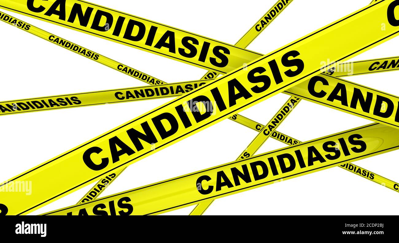 Candidiasis. Yellow warning tapes with black words CANDIDIASIS ...