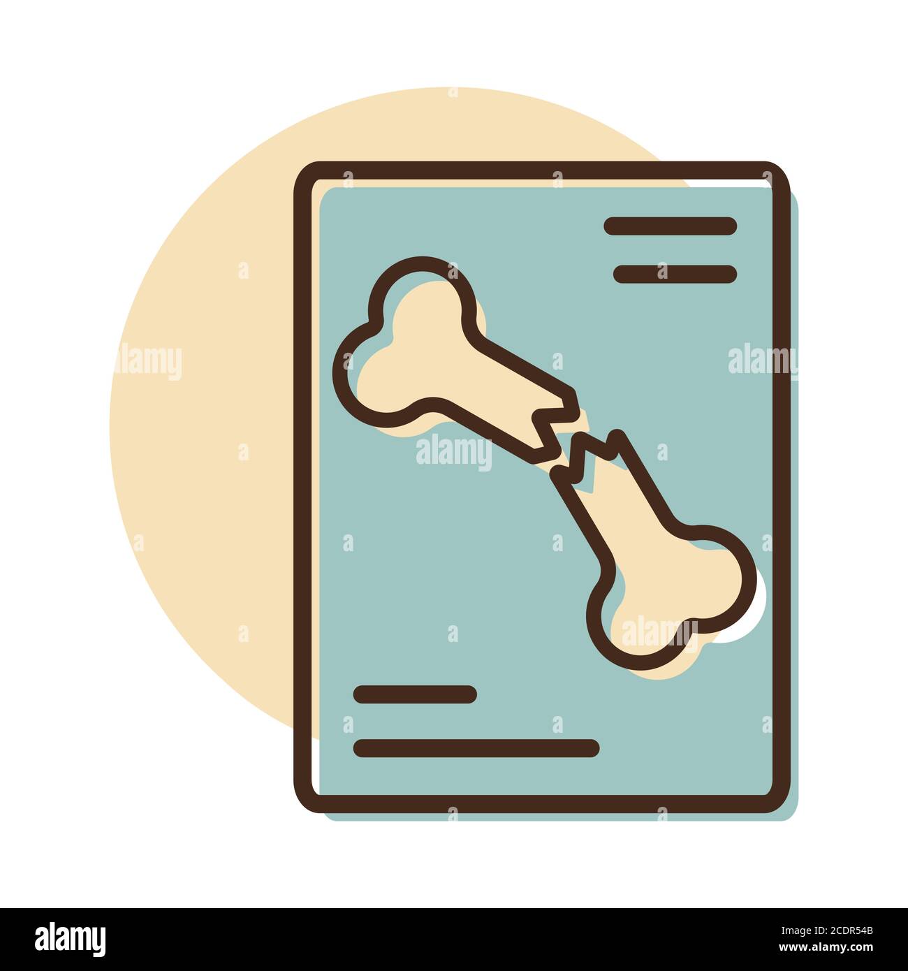 Bone fracture X-ray scan vector icon. Medicine and healthcare, medical ...