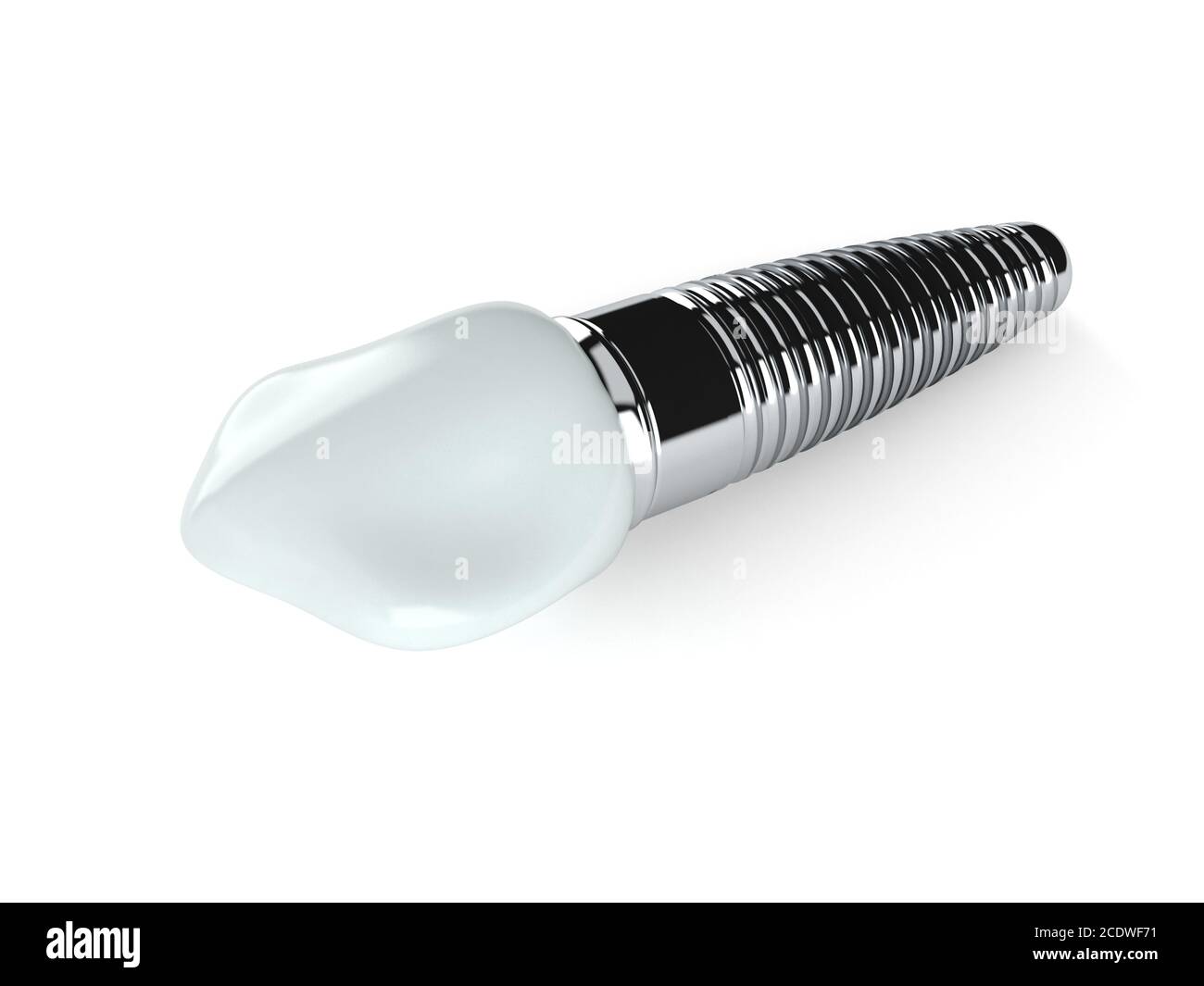 Dental implant isolated on white background Stock Photo - Alamy